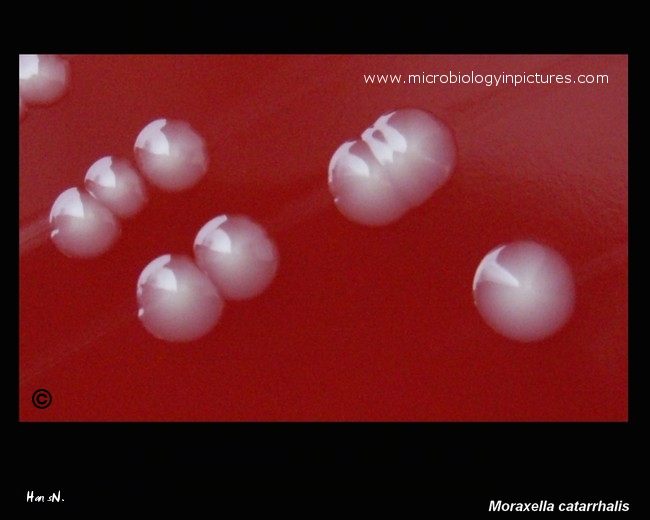 Moraxella catarrhalis morphology of colonies growing on blood agar.